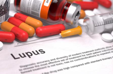 What Is Lupus?